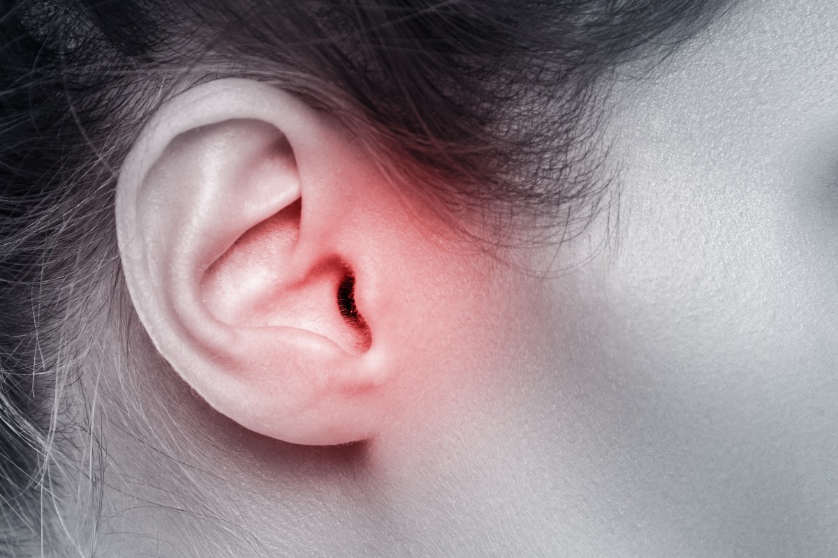 A dive into otitis externa: Understanding Swimmer’s ears – Dr. Preethi ...