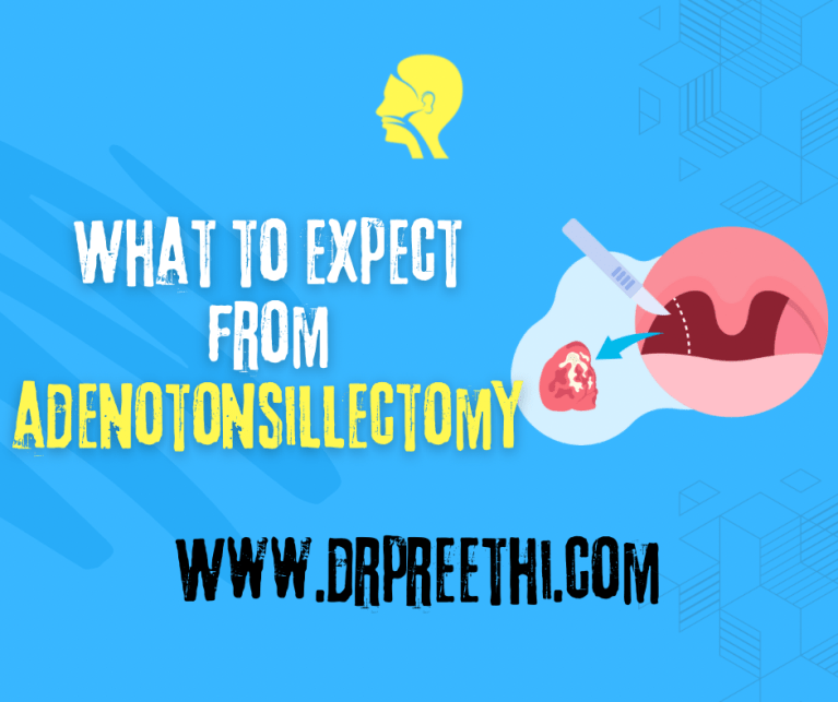 Tonsillectomy and Adenoidectomy: A Guide to What to Expect – Dr ...