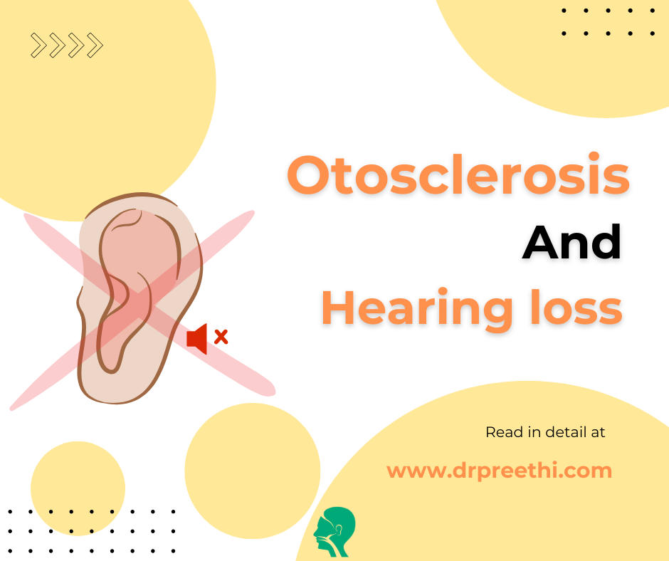 Otosclerosis: Understanding a Common Cause of Hearing Loss – Dr ...