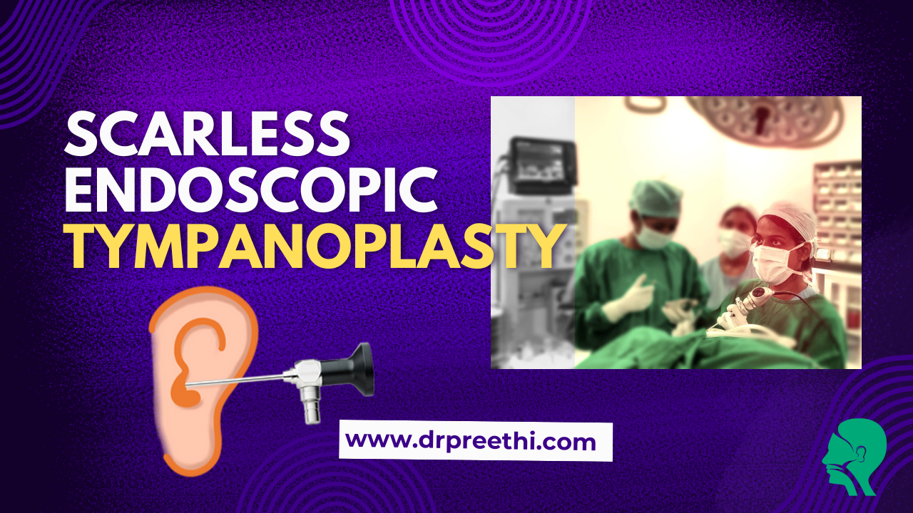 Scarless tympanoplasty: A guide for patients – Dr. Preethi ...