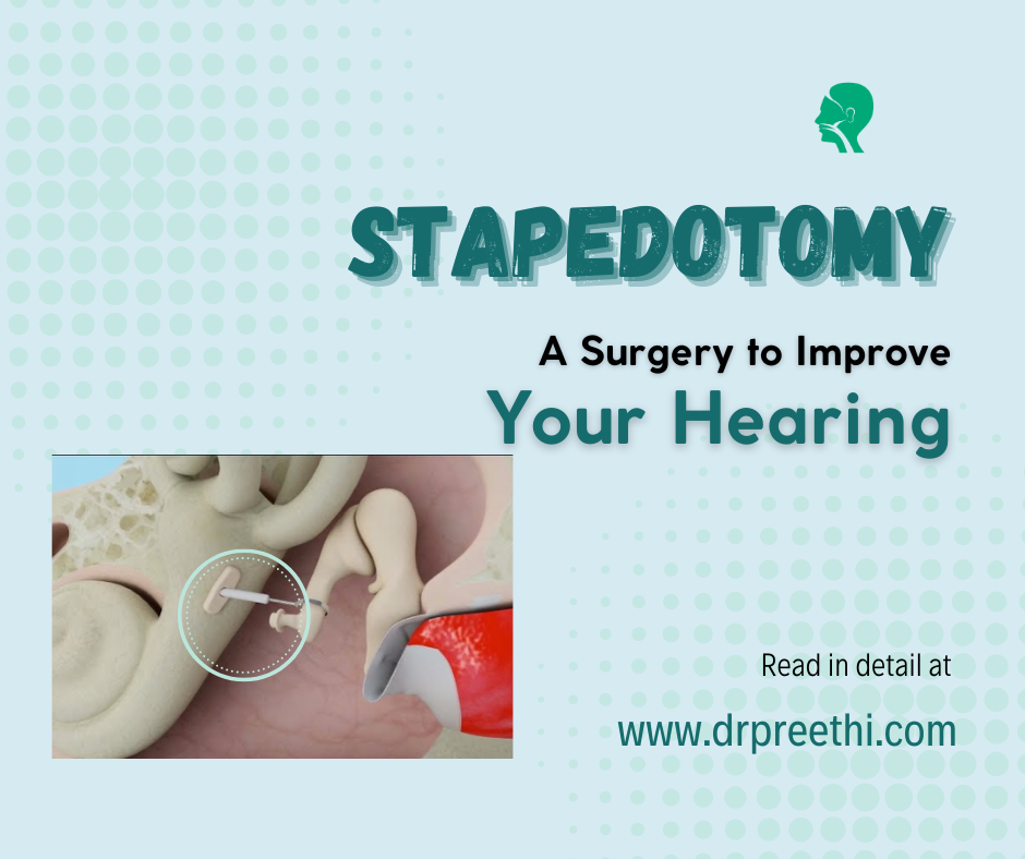 Stapedectomy: A Tiny Surgery, A Big Impact – Dr. Preethi Umamaheswaran ...