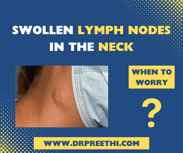 common causes of Swollen Lymph Nodes: When to Consult an ENT – Dr ...