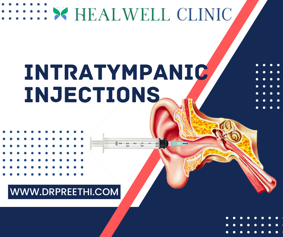 risks & Benefits of intratympanic injections – Dr. Preethi ...