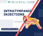 risks & Benefits of intratympanic injections – Dr. Preethi ...
